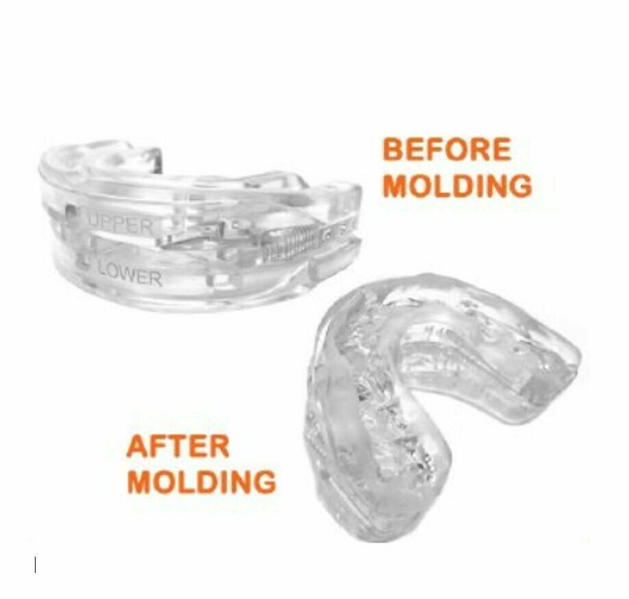 Sleep Aids Anti Snoring Mouth Guards Stop Snoring Mouthpiece Adjustable ...
