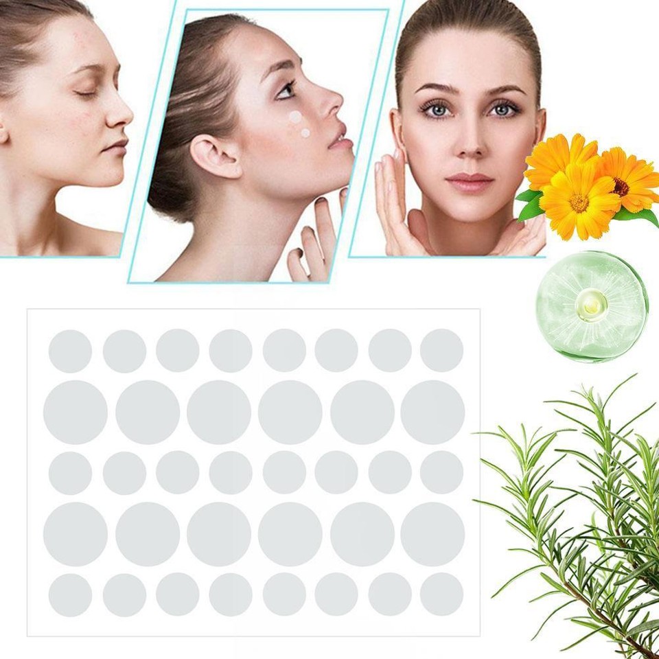 216 Pimple Patches Dots Hydrocolloid Acne Spot Stickers Cystic Acne ...
