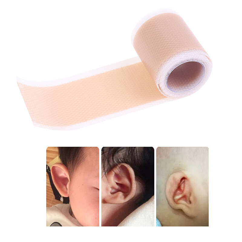 Newborn Baby Ear Correction Tape Ear Aesthetic Correctors Infant ...
