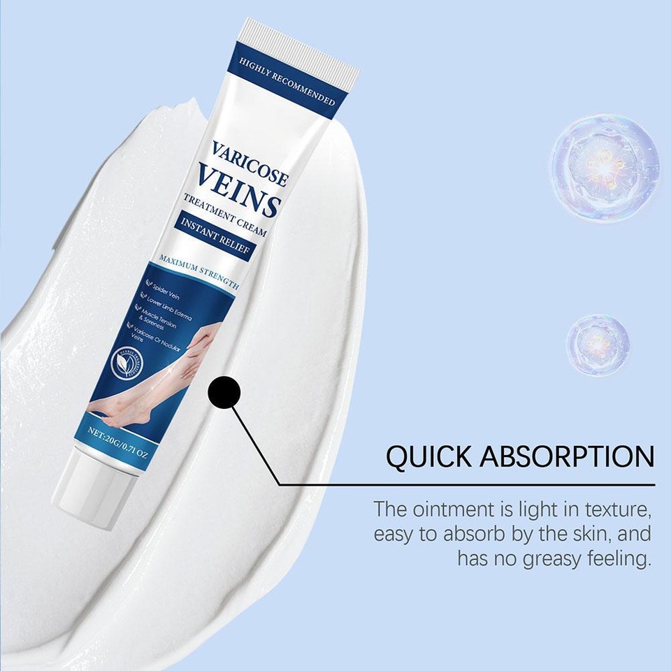 Vein Healing Varicose Veins Treatment Cream Anti Swelling Spider Leg ...