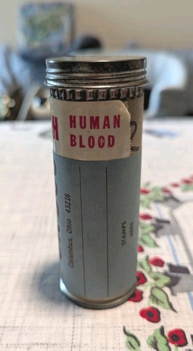 Vintage Laboratory Blood Testing Mailing Tube with Vials | eBay