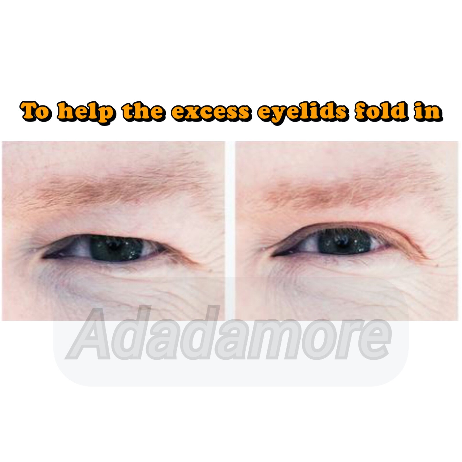 Instant Eyelid Lift Eye Strips Supporting Eyes Push Up Anti Ageing ...