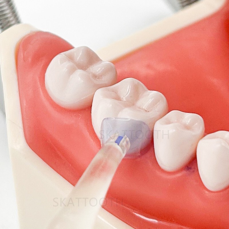 Dental Transparent Cervical Matrices Composite Gingival Retractor Clear ...