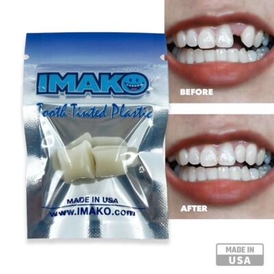 Imako® Tooth Tinted Plastic - Temporary Tooth - Fix Chipped Teeth, Gaps ...