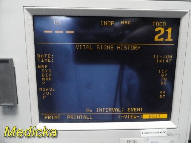 GE 120 Series Model 0128 Maternal Fetal Monitor W/ Transducers & Leads ...