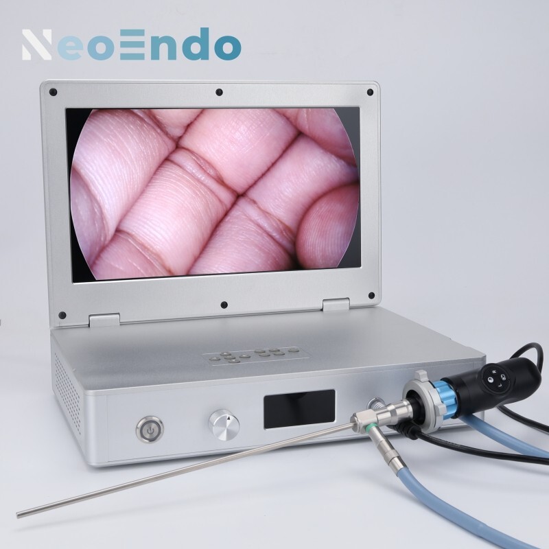 HD Portable Medical Endoscope Camera With 15.6 Inch Monitor 80W Light ...