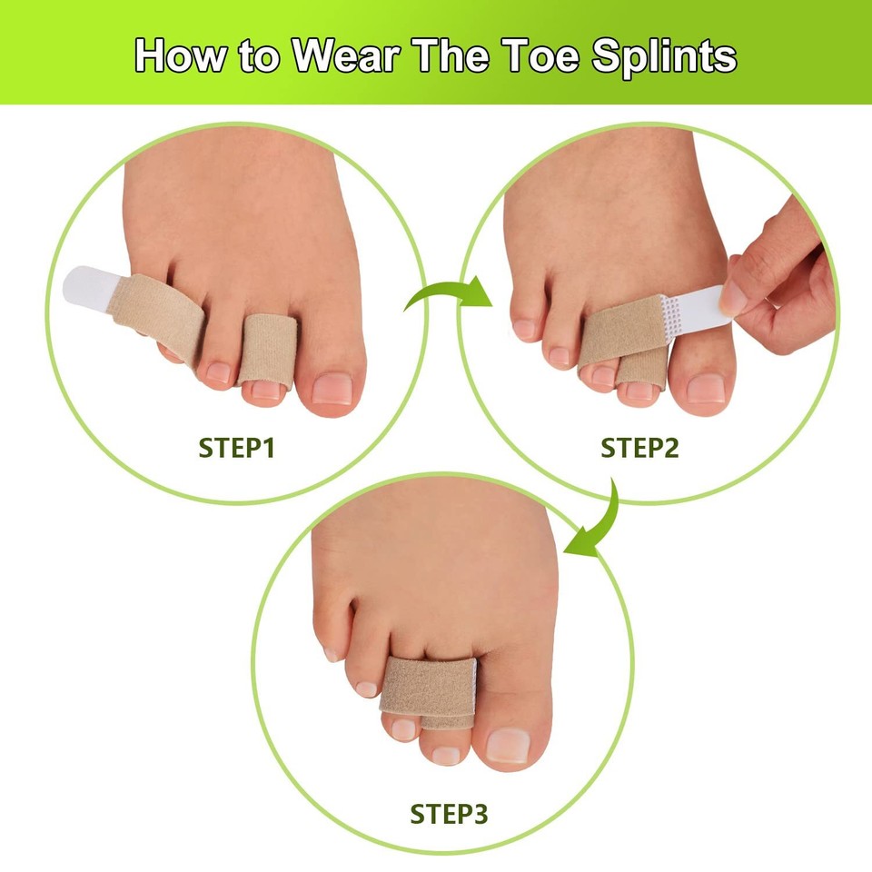 Up-Grade Hammer Toe Straighteners for Bent Toes 12 Pack Toe Splints Toe ...