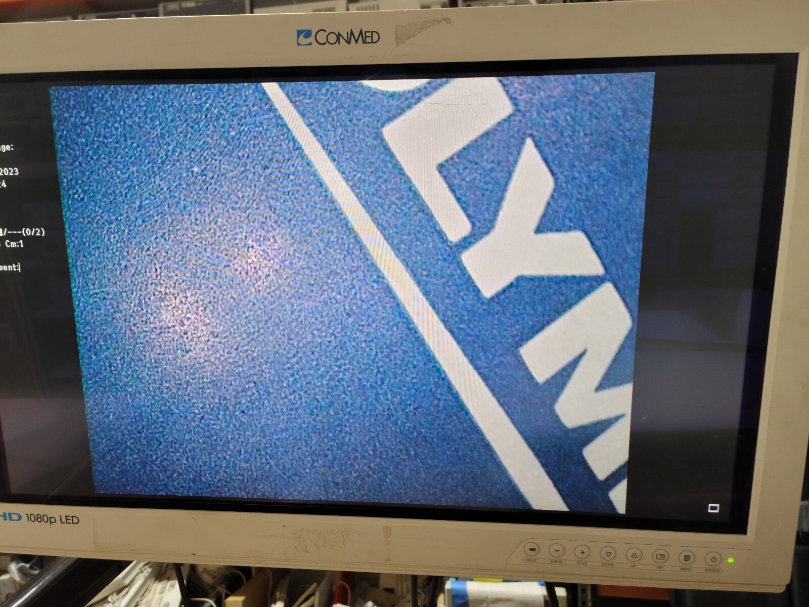 Olympus WA53005A Rigid Laparoscope, 10 mm, 30° for sale online | eBay