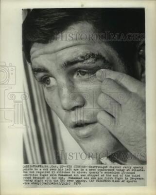 1970 Press Photo Heavyweight boxer Jerry Quarry shows cut that stopped ...