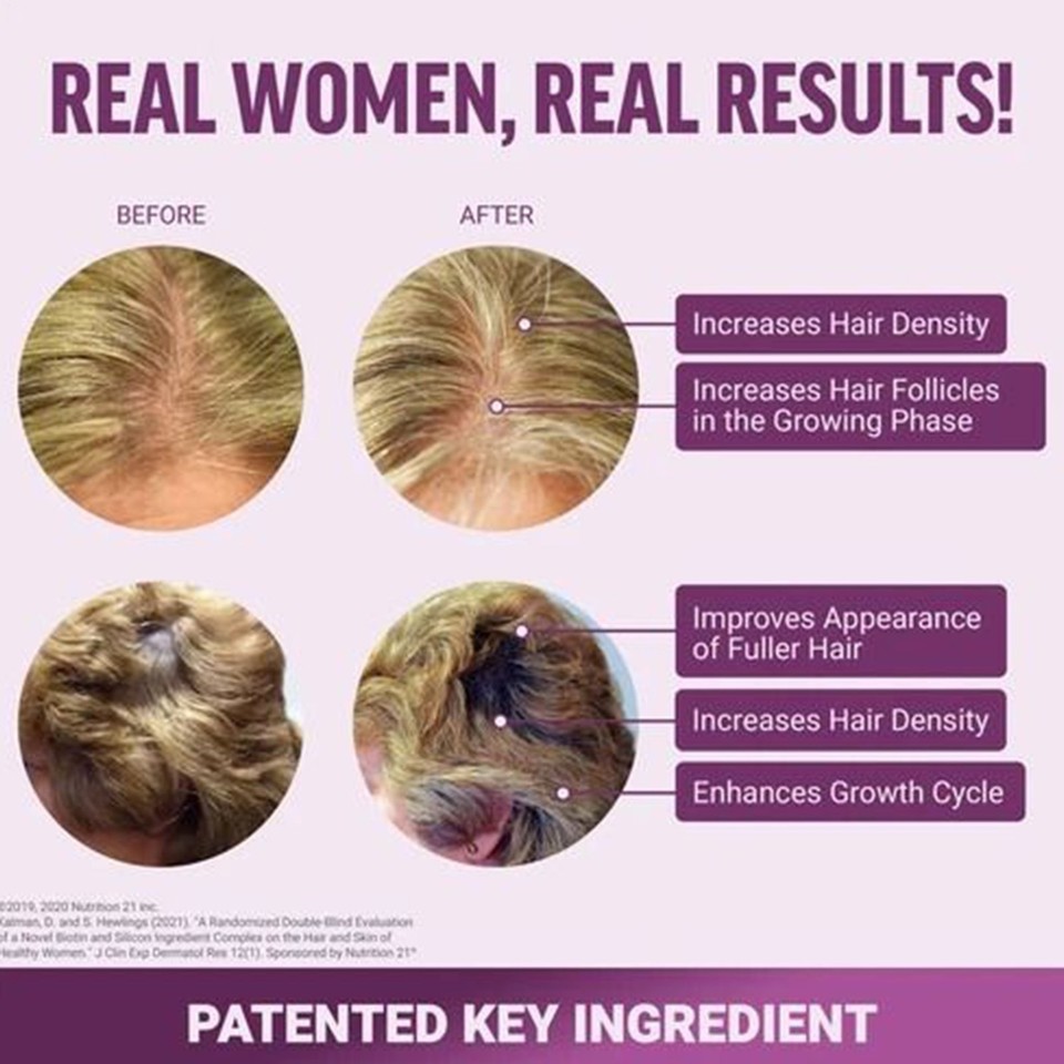 Enhance Hair Growth: Force Factor Hair Growth Accelerator Soft Chews ...