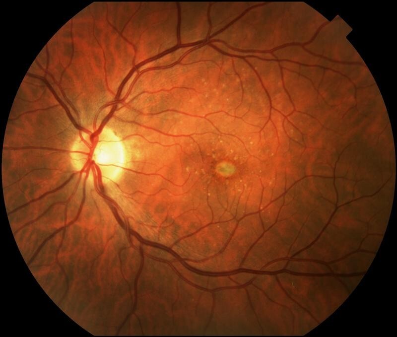 Topcon TRC-50DX ICG Retinal Camera with Imagenet 5 Color/Red-Free/FA ...