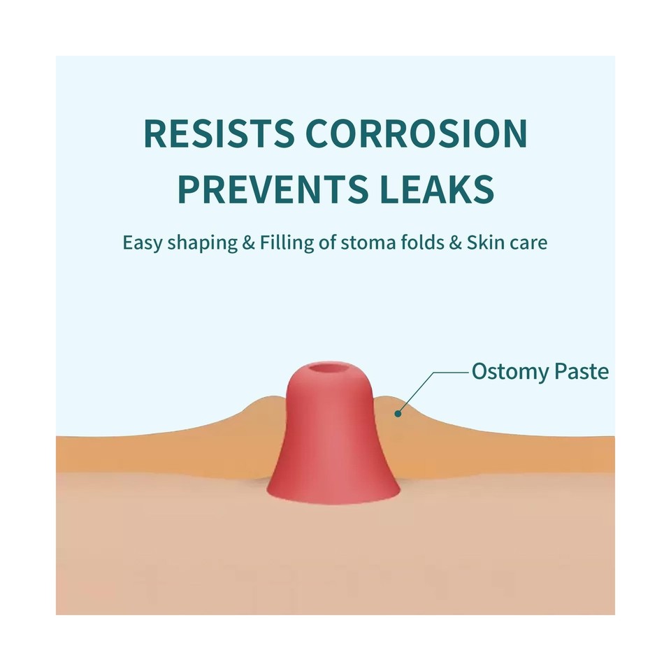 Ostomy Paste, No-Sting Skin Barrier Paste, Ostomy Filler Paste for ...