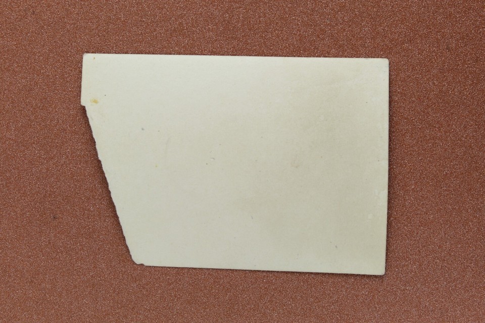 Surgeons Leg amputation WWII Ukraine Bogotol hospital USSR real photo ...