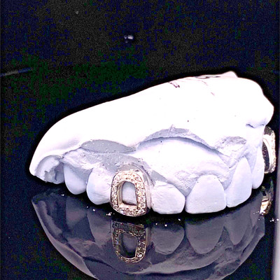 VS DIAMOND - OPEN FACE- CANINES - 2 TEETH - CUSTOM FITTED- GRILLZ ...