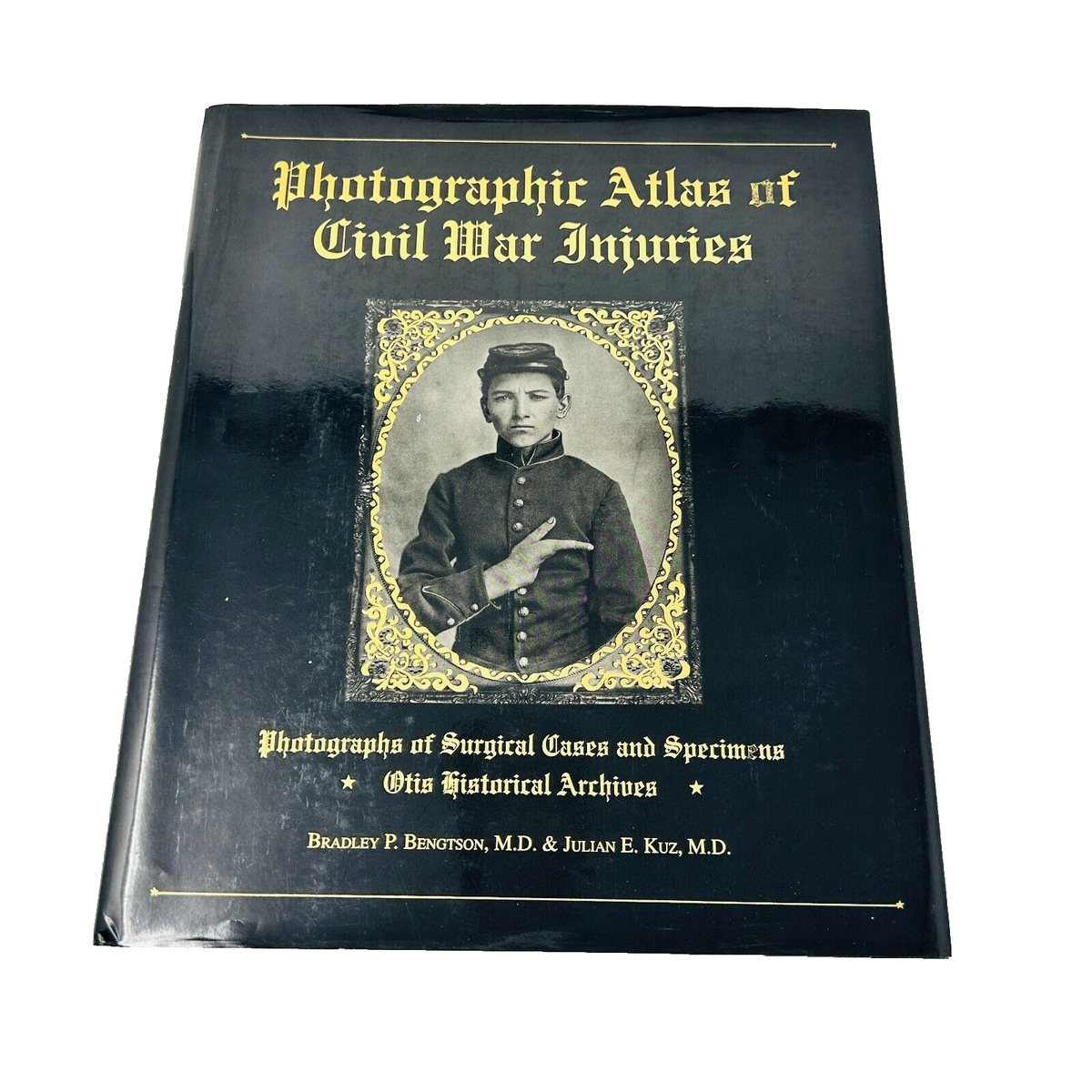 Injuries Civil War Photo Book Portraits Of Injured Civil War Soldiers