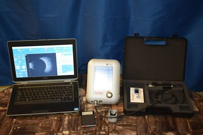 Quantel Aviso B-scan ophthalmic ultrasound | eBay