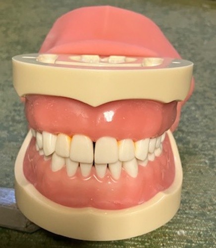 Nissin Dental Typodont Model 32 pcs, Removable Teeth | eBay