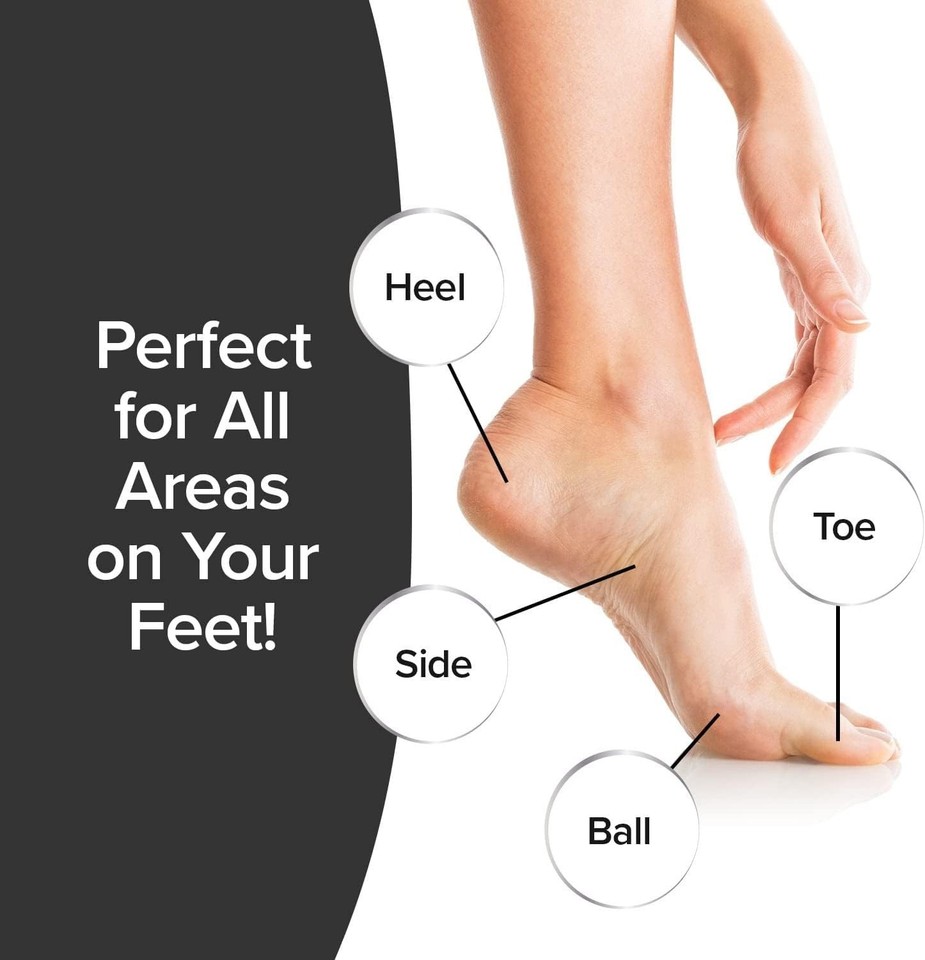 PedEgg Classic Foot File – Safely & Painlessly Remove Tough Calluses ...