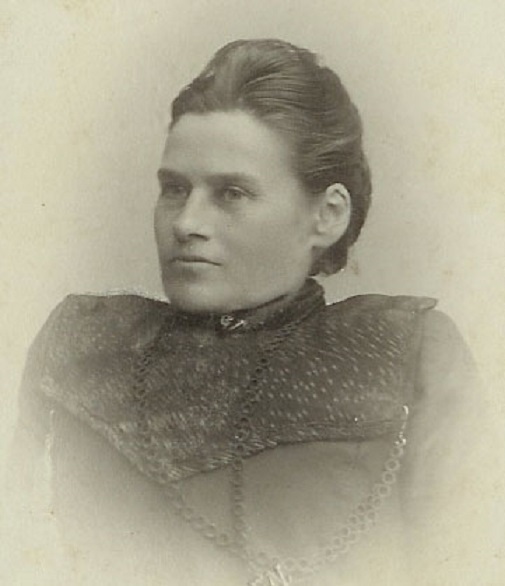 FREAK STRANGE ODD RARE CDV: Woman with No Neck Medical Anomaly Carte de ...