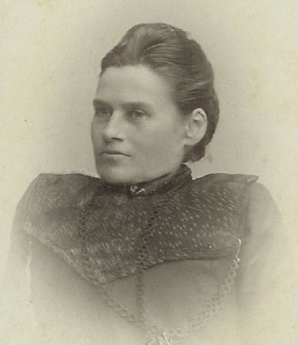 FREAK STRANGE ODD RARE CDV: Woman with No Neck Medical Anomaly Carte de ...