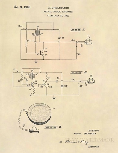 Heart Pacemaker US Patent Art Print - Official Pace Maker Doctor ...