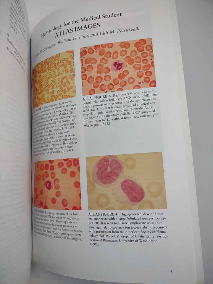 Hematology for Medical Students by Alvin H Schmaier: Used 9780781731201 ...