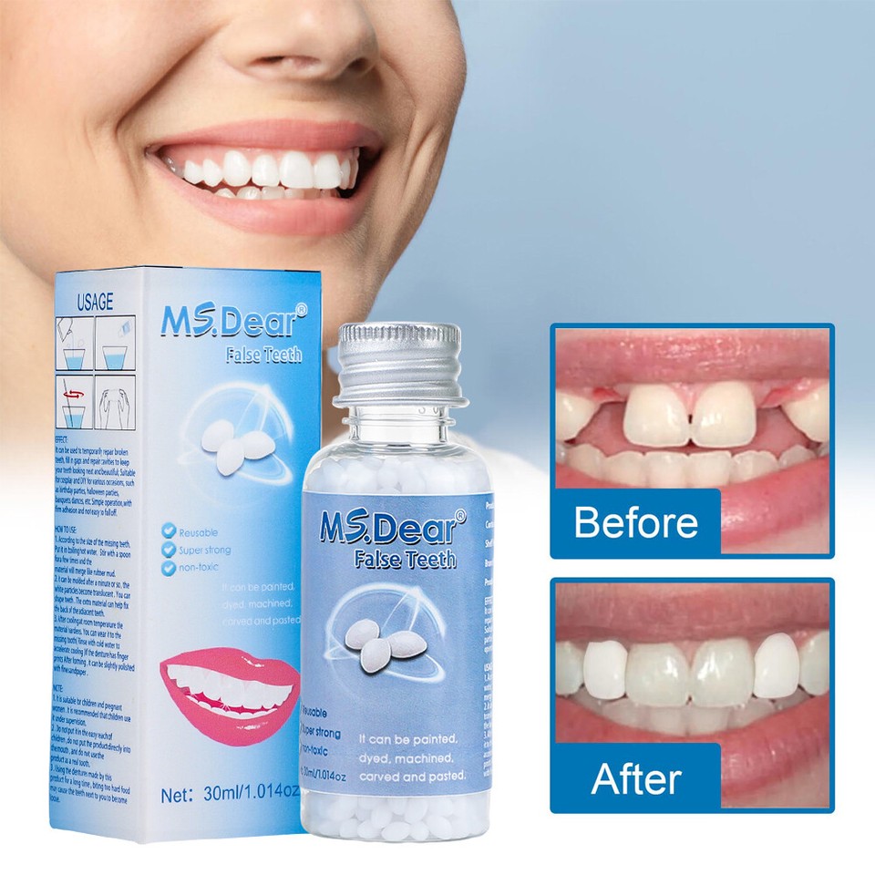 5/3Pcs Temporary Tooth Repair Kit Fix Broken Teeth Fill Gaps Denture ...