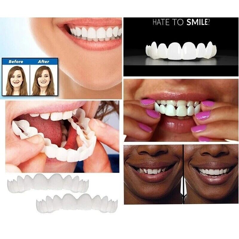 Smile Snap on False Teeth Set for Eat & Drink Denture Veneers Dental ...