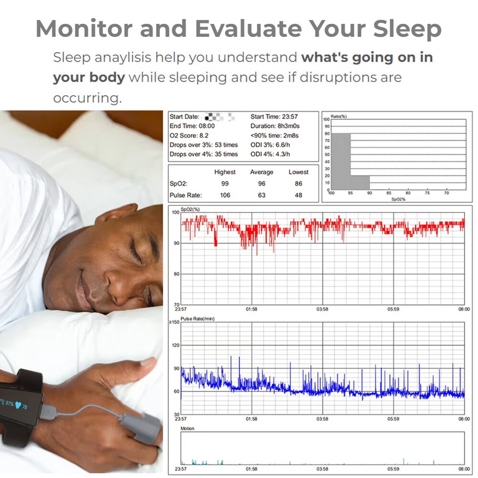Wellue O2 Max with O2 Ring Probe 72 Hours Continuous Pulse Oximeter ...