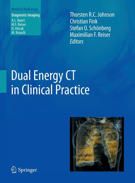 Dual Energy Ct in Clinical Practice von Thorsten Johnson Maximilian F ...