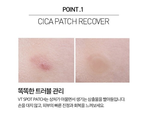 [VT COSMETICS] VT CICA X CARE SPOT PATCH 48ea(per 1pack) K-Beauty | eBay