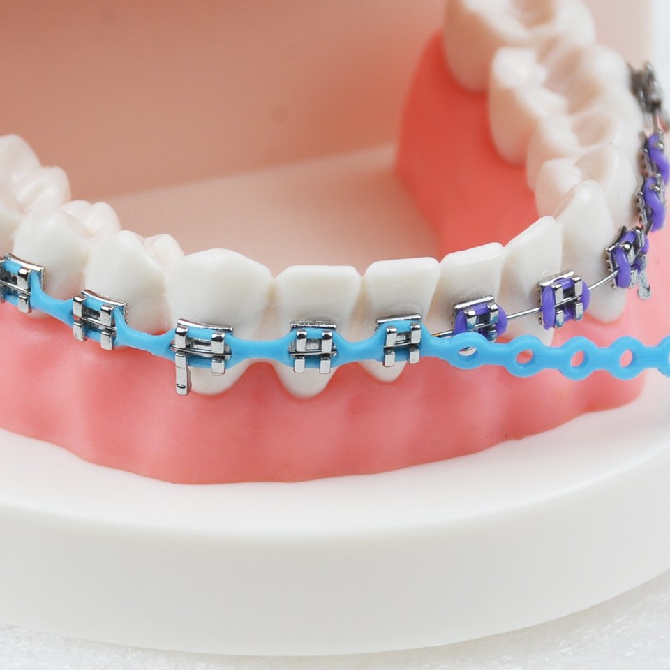 Orthodontic Power Chain Rubber Bands 15FT Short Type 10 Colors for ...
