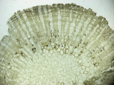 Mississippian Carboniferous Rhombopora bryozoa fossil thin section St ...