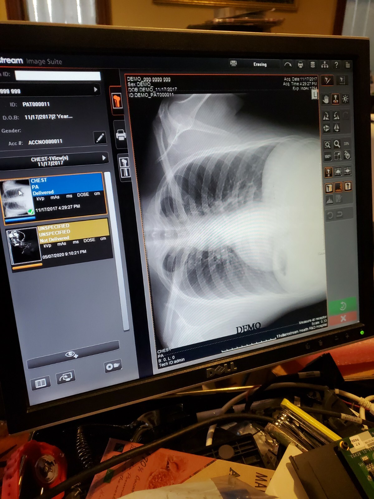 digital xray CR reader fuji or carestream | eBay