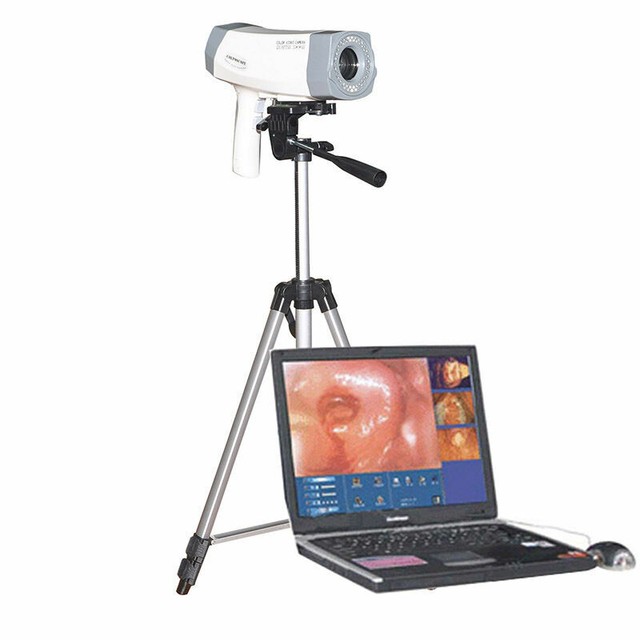 480 000 Digital Video Electronic Colposcope Sony Camera Gynecology ...