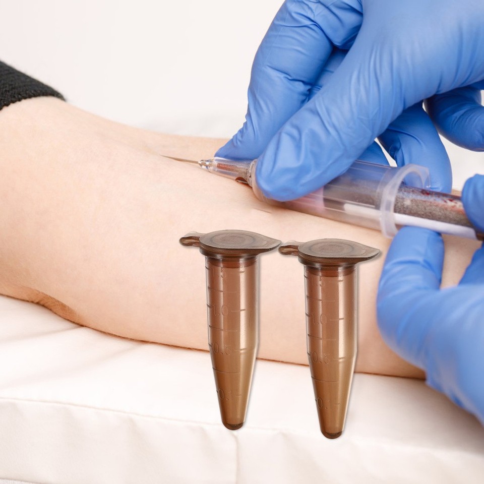 500 Pcs Plastic Centrifuge Vials Microcentrifuge Tubes Mini Test | eBay UK