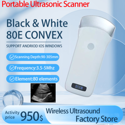 Wireless Ultrasound Convex Probe 3.5/5 mhz 80 element Scanner Portable ...