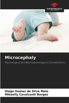 Microcephaly by Diego Gomes Da Silva Melo Paperback Book | eBay