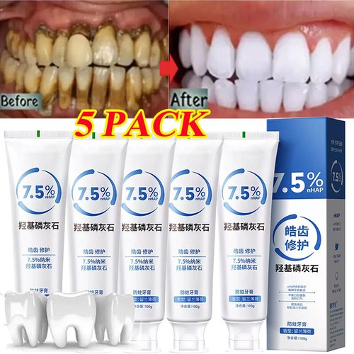 7.5% Hydroxyapatite Toothpaste Remove Yellow Tooth Stains For Sensitive ...