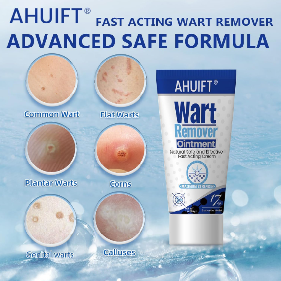 Wart Relief Cream for Genital, Plantar, Common, Flat & Filiform Warts ...