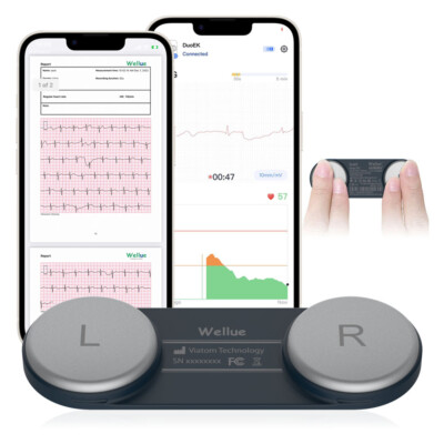 ECG & EKG Systems - Ecg Ekg Cables