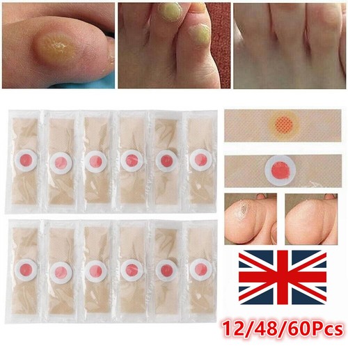 12/48/60X Foot Corn Remover Pads Plantar Wart Thorn Plaster Patch ...
