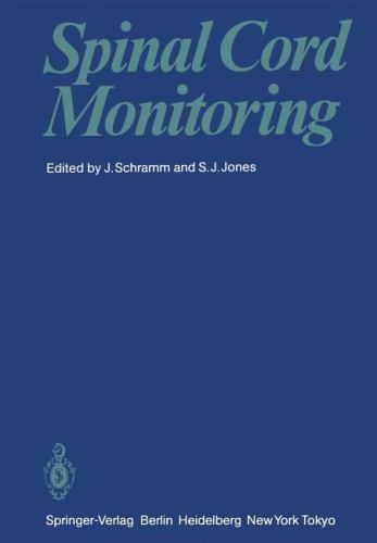 Spinal Cord Monitoring by Stephen J. Jones (2011, Trade Paperback) for ...