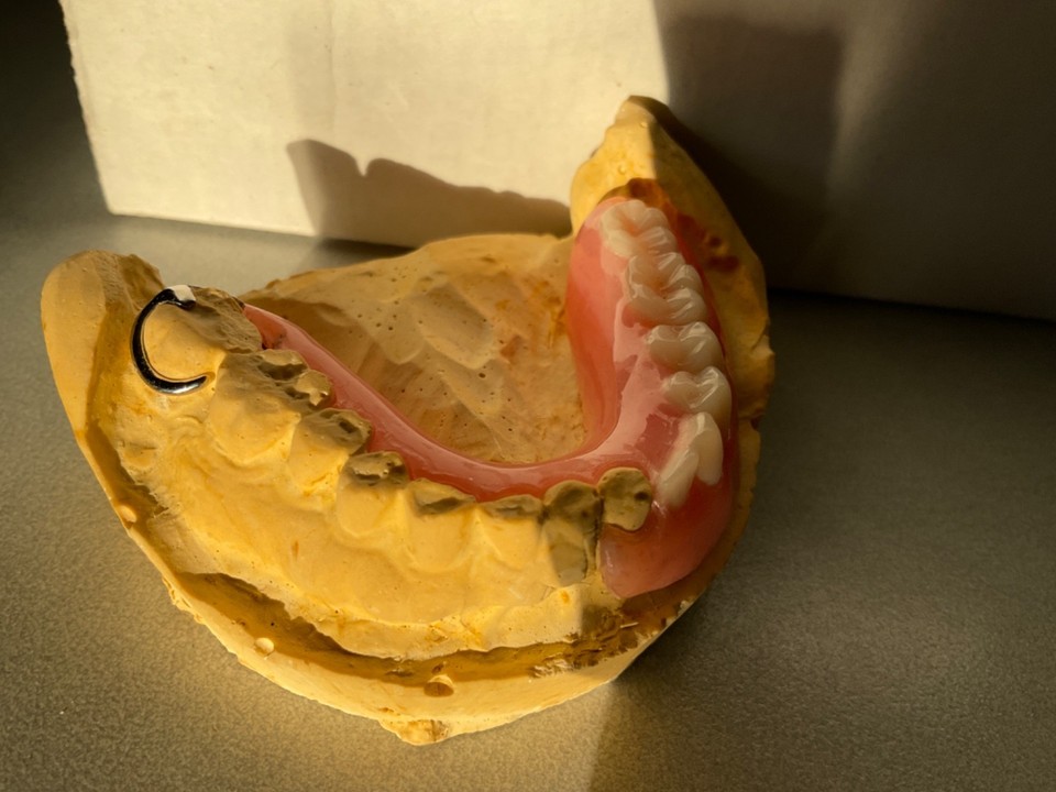 Vintage Lower Partial (False Teeth) Acrylic on model display ~ Dental ...