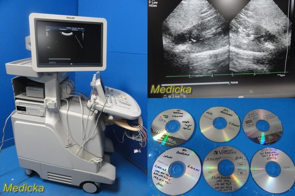 Philips IE33 Diag. Cardiac Ultrasound W/ S5-1, S12-4, C9-4 & Pencil ...