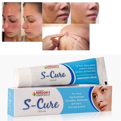 Bakson's S-Cure Cream Treat acne, pigmentation, sunburn, scarring ...