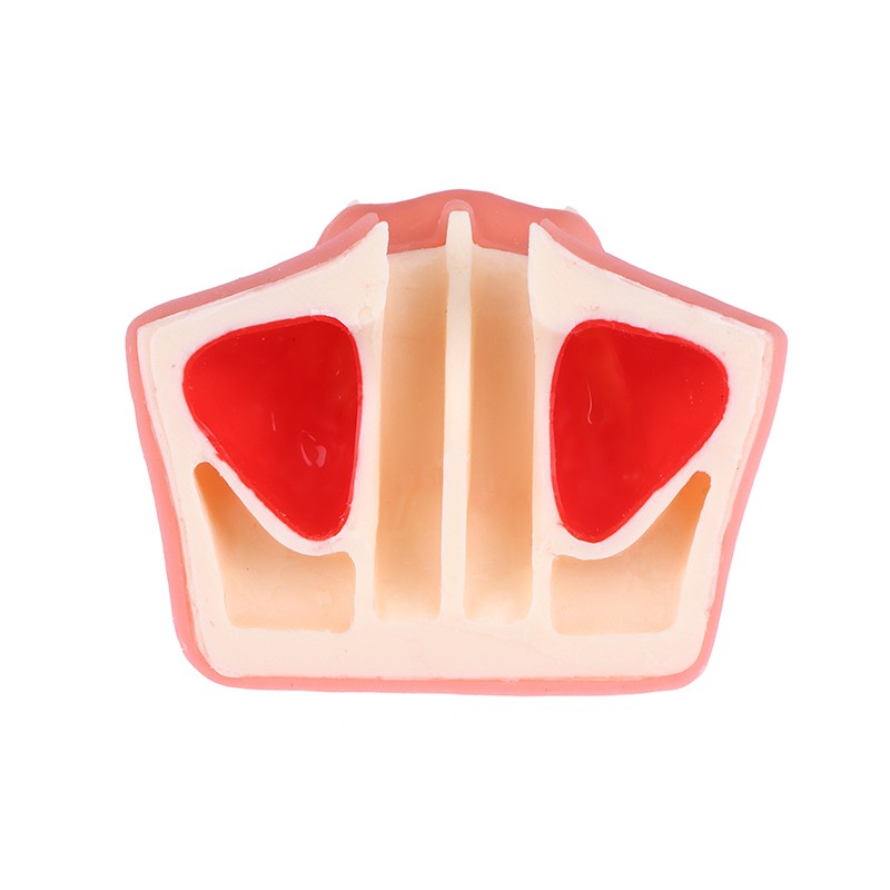 Maxillary Model With Sinus Implantology Dental Typodont Implant Tooth ...