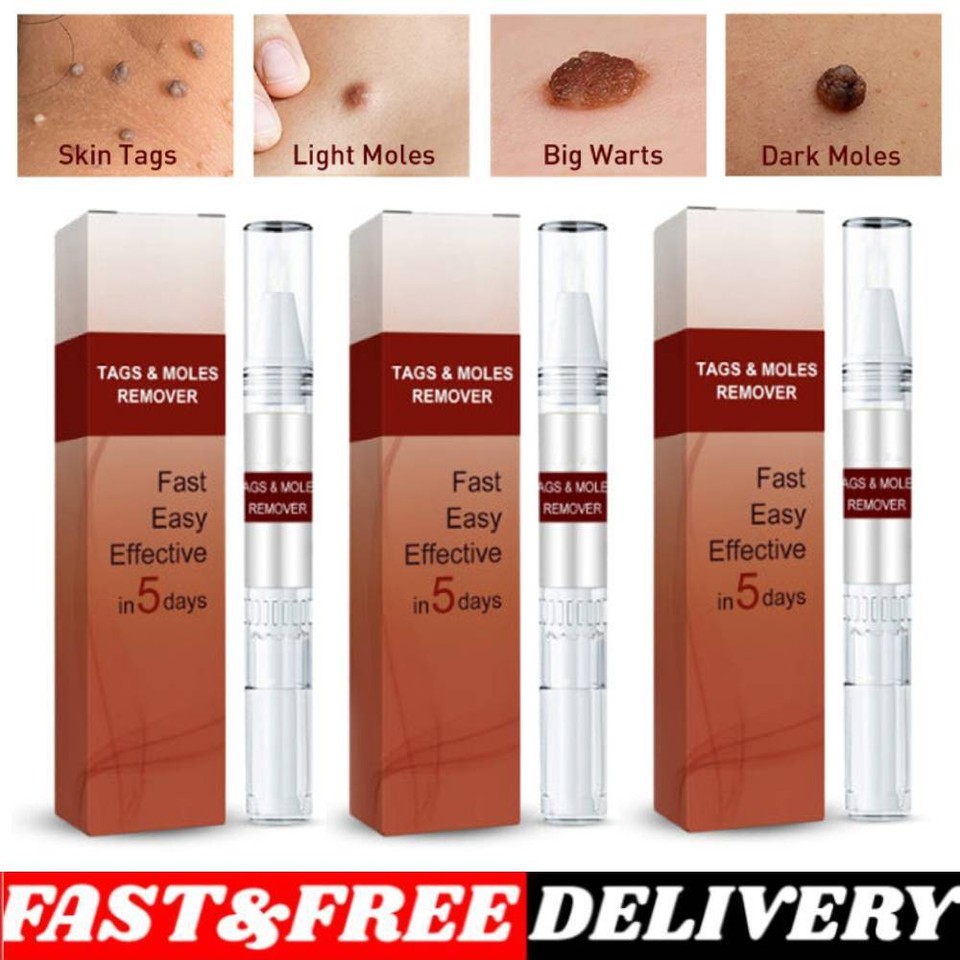 5PCS Wipe Off Skin Tags & Moles Removal Quick Safe Remover Restore Skin ...