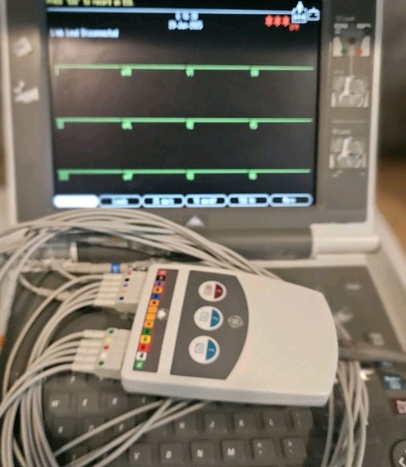 GE MAC 5500 ECG EKG Machine CAM 14, Leads, WITHOUT CART-SEE DESCRIPTION ...