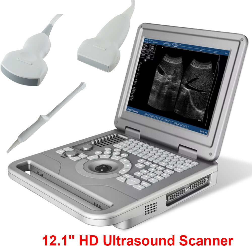 Portable Ultrasound Machine